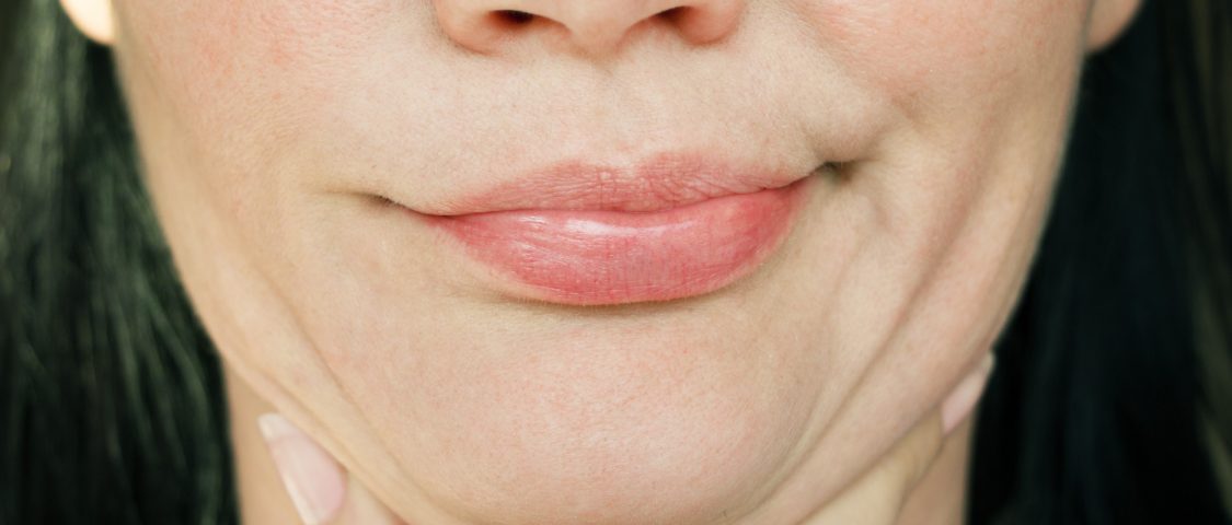 Tired of Your Chin Roll? Say Goodbye with These Double Chin Procedures ...