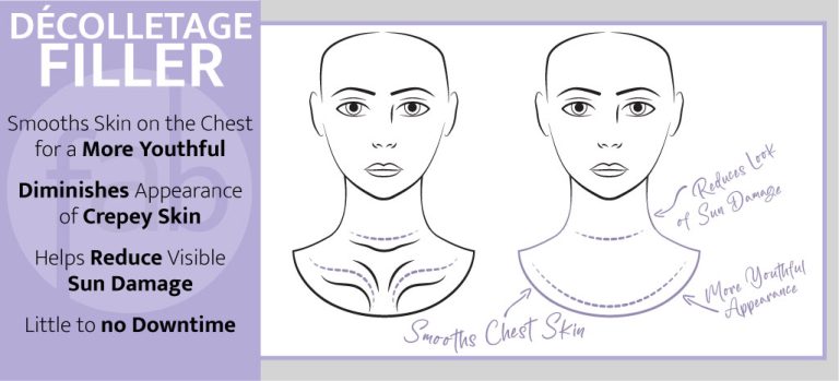 Décolletage Filler | Atlanta Face & Body